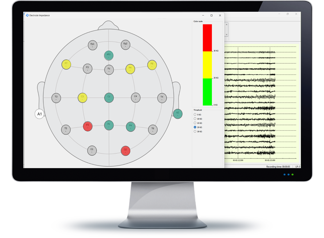 NeuroSees Software – Medinateb Neuroscience Products