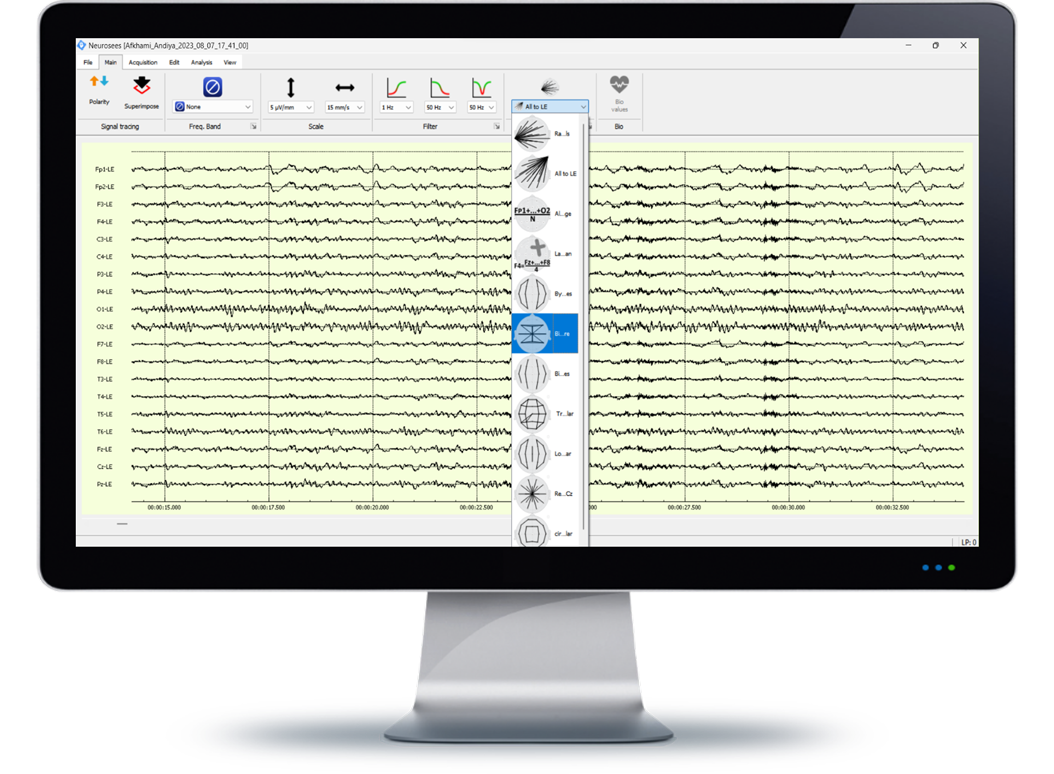 NeuroSees Software – Medinateb Neuroscience Products