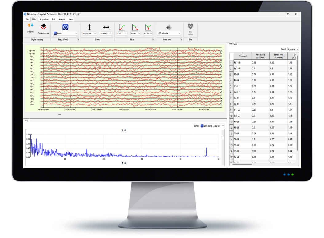 NeuroSees Software – Medinateb Neuroscience Products
