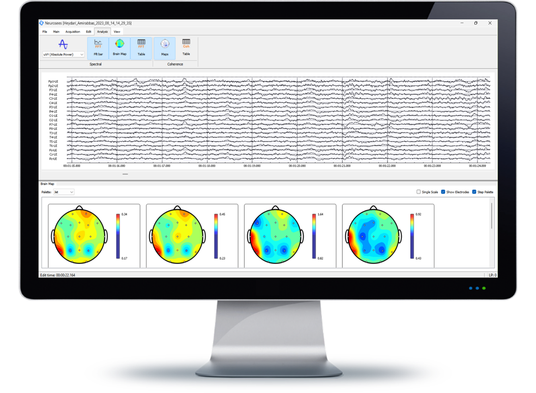 NeuroSees Software – Medinateb Neuroscience Products