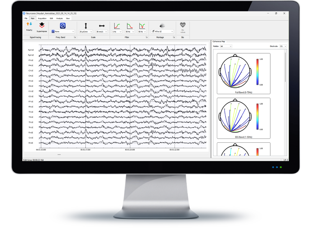 NeuroSees Software – Medinateb Neuroscience Products