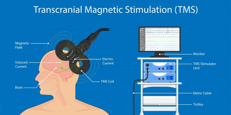 transcranial magnetic stimulation – Medinateb Neuroscience Products