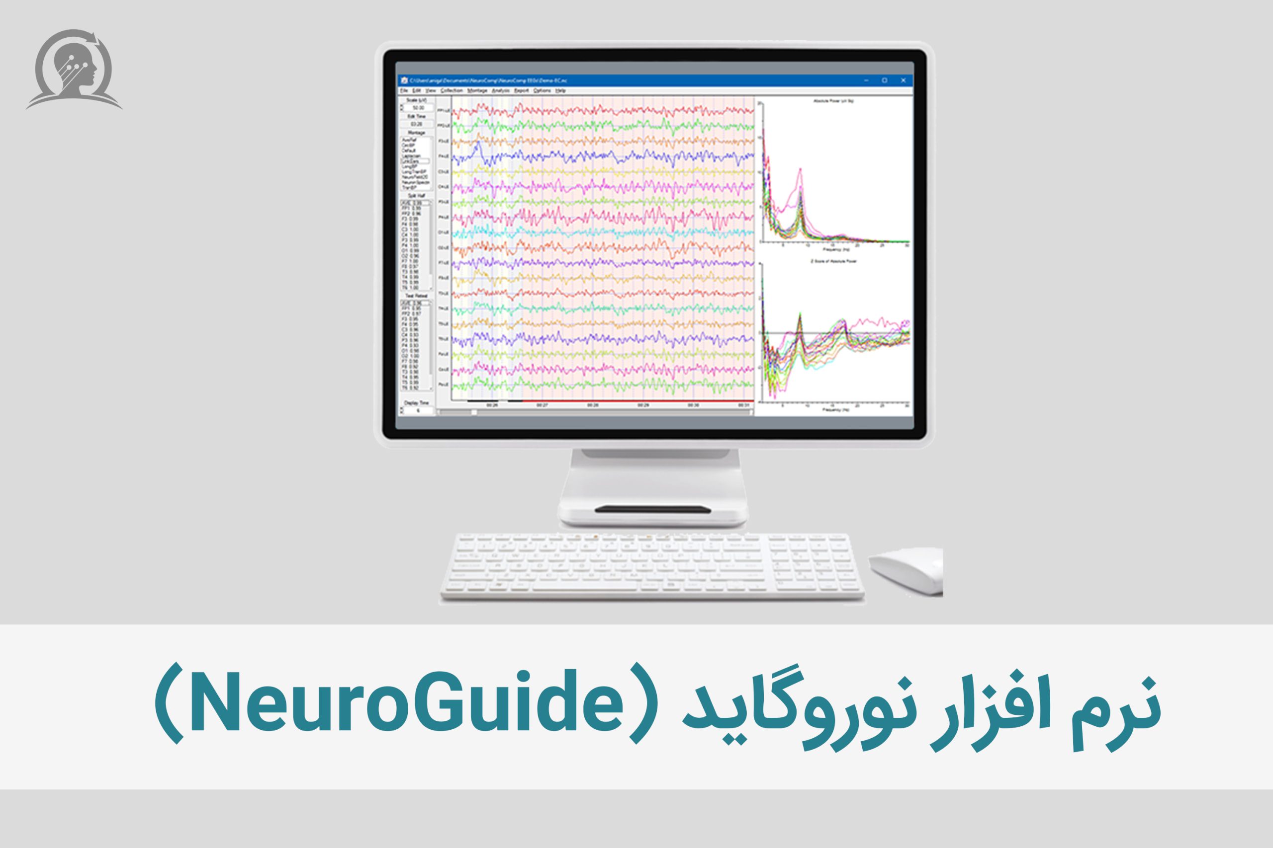 نرم افزار نوروگاید (Neuroguide) چیست؟ - مدیناطب پیشرو در ارائه جدید ...